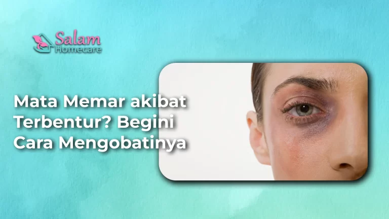 Mata Memar akibat Terbentur? Begini Cara Mengobatinya - Salam Homecare