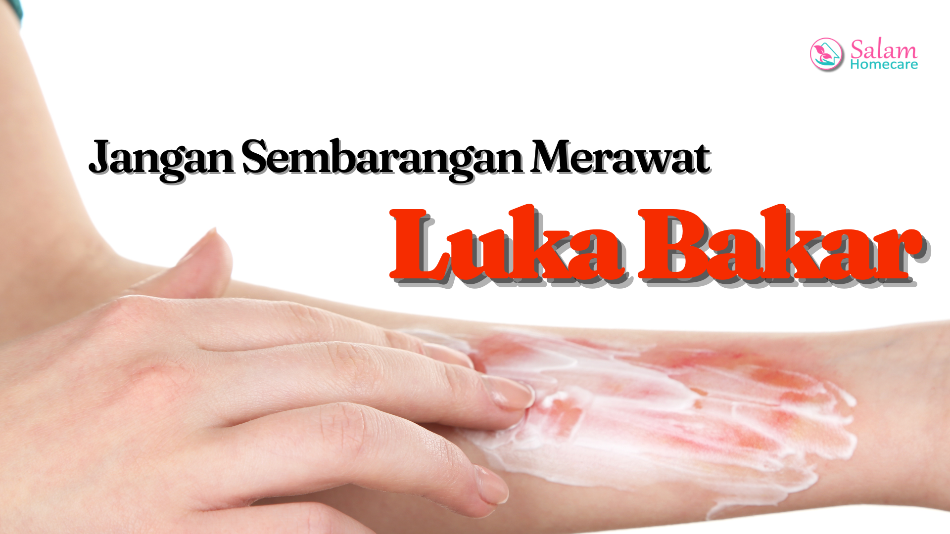 Perawatan Luka Bakar, Begini Caranya - Salam Homecare
