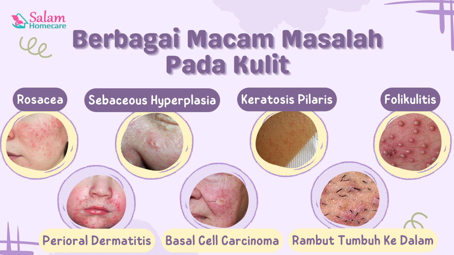 Berbagai Macam Permasalahan Kulit Selain Jerawat - Salam Homecare