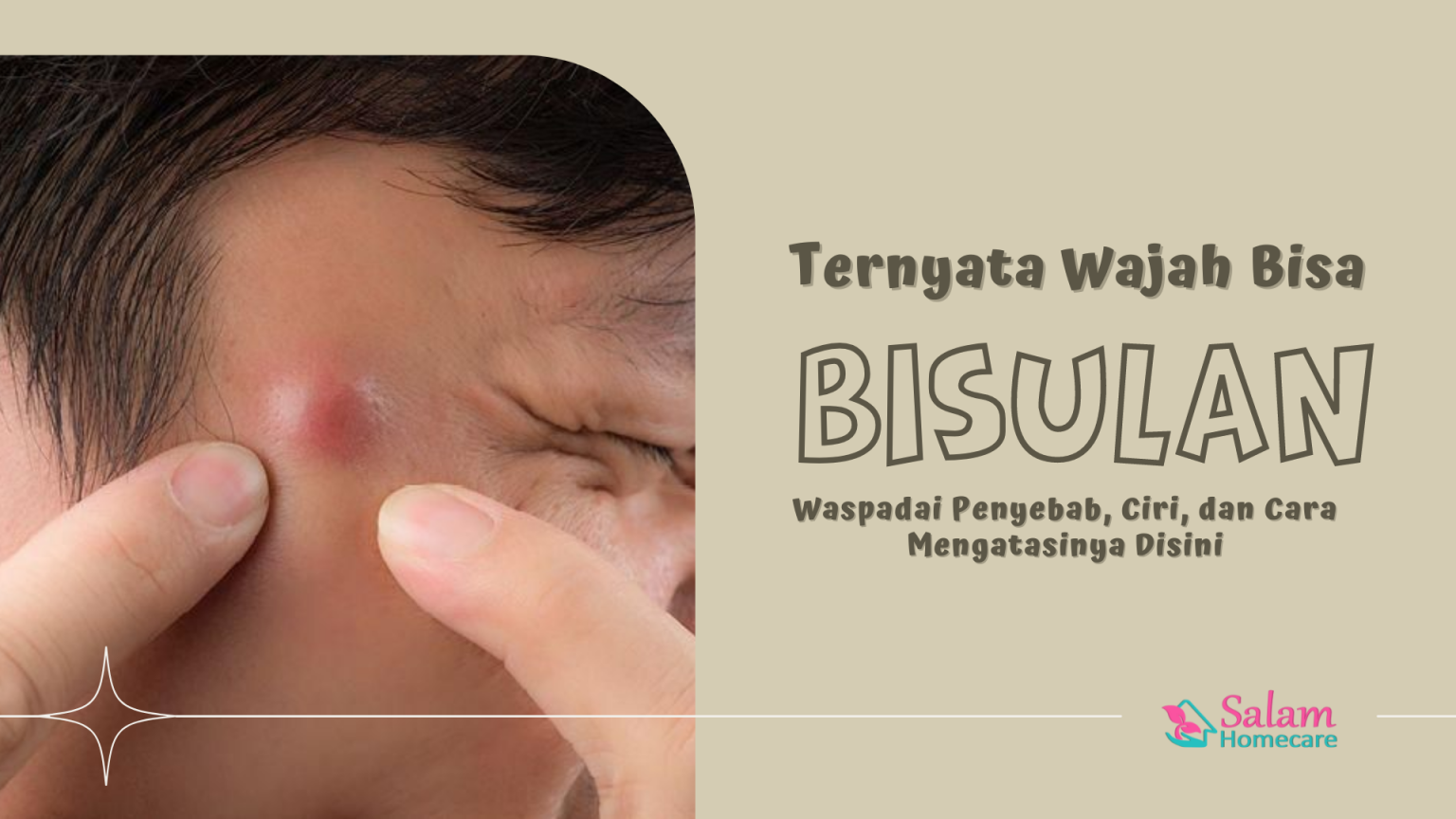 Ternyata Wajah Bisa Bisulan Juga Lho! - Salam Homecare