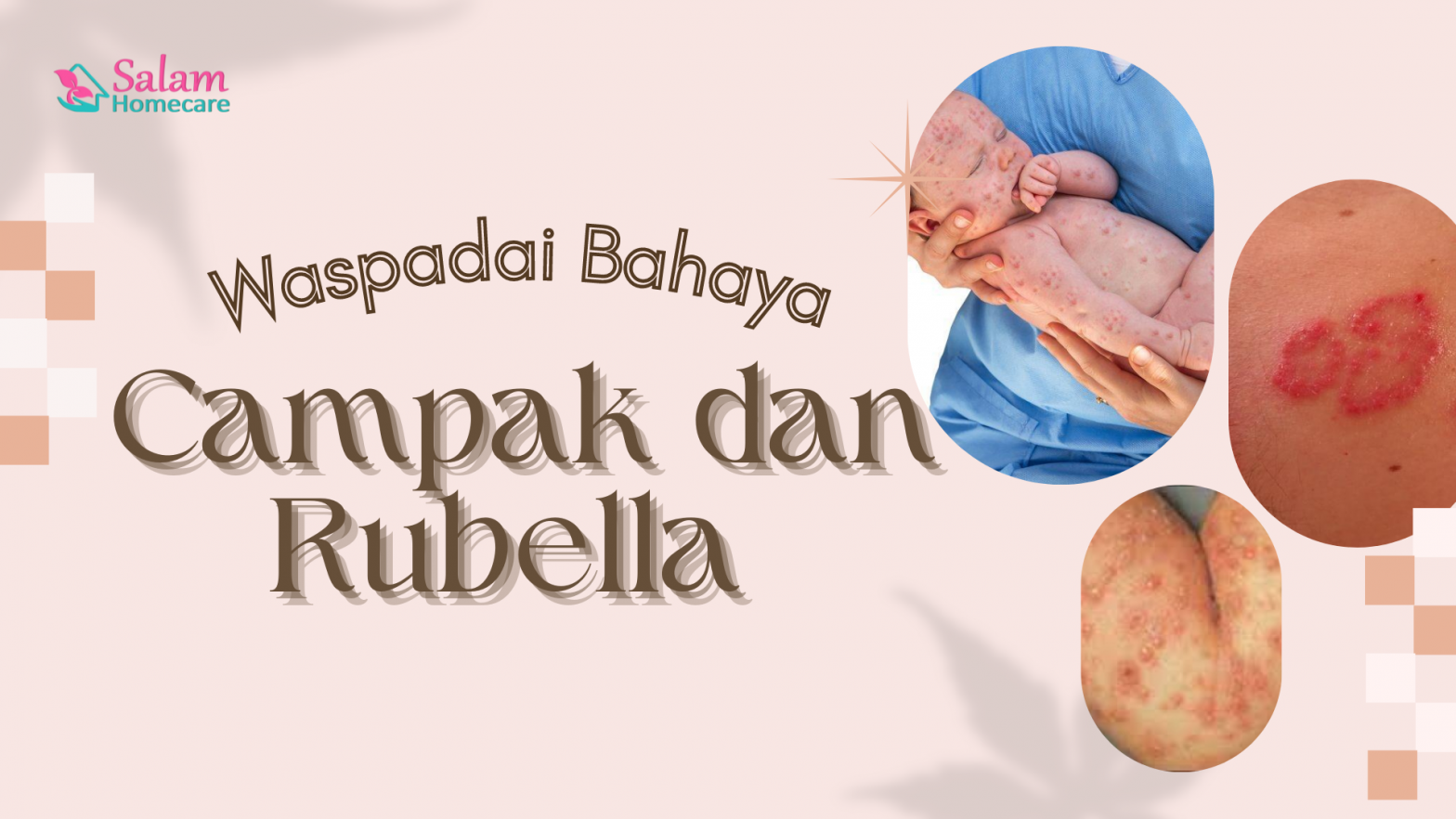 Jarang Disosialisasikan, Waspadai Bahaya Campak dan Rubella - Salam ...