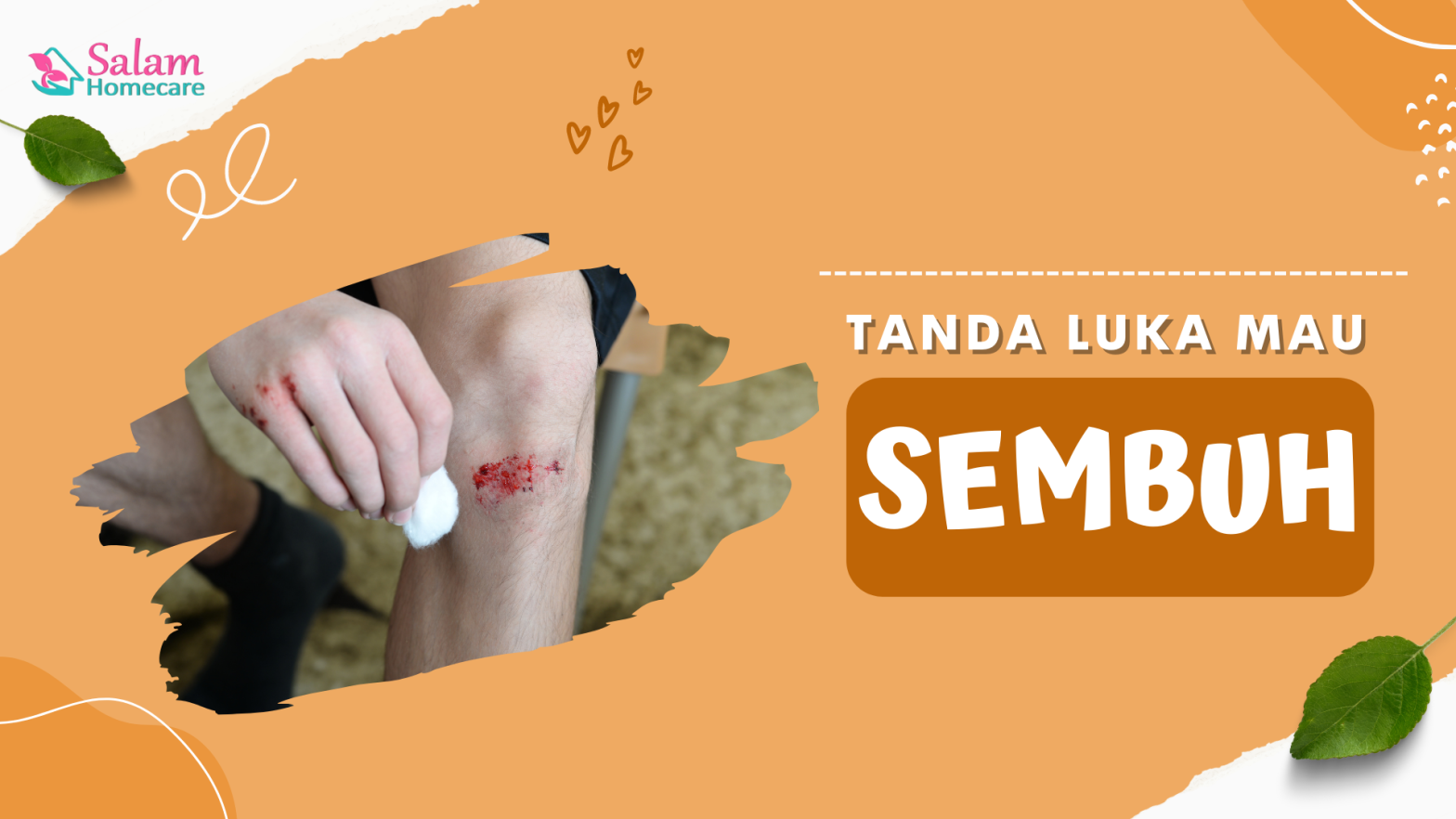Begini Tanda Luka Mau Sembuh - Salam Homecare