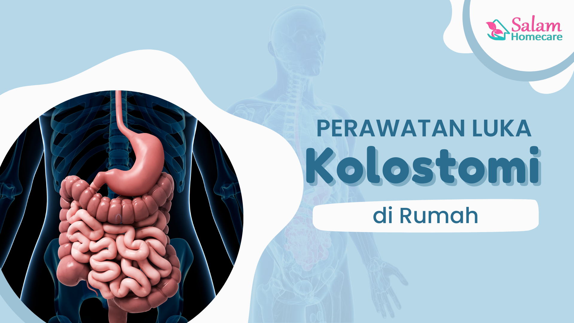 Perawatan Luka Kolostomi di Rumah - Salam Homecare