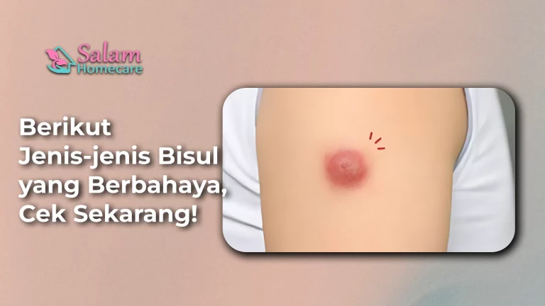 Jenis Bisul yang Berbahaya dan Cara Mengobatinya - Salam Homecare